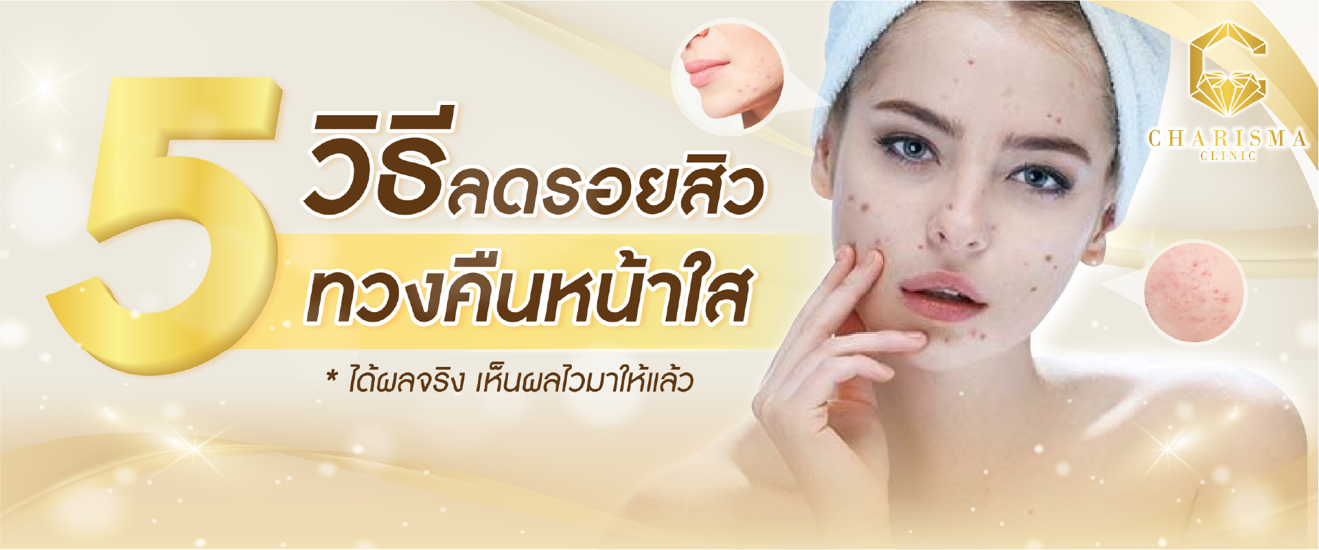 DERMA MATRIX - Charisma Clinic ชาริสม่า คลินิก
